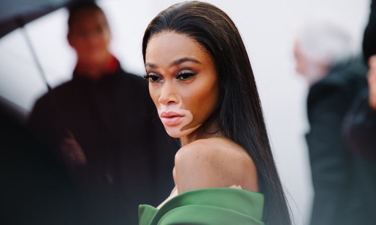 Winnie Harlow Net Worth 2024: Age, Height, Weight, Boyfriend, Dating, Kids, Bio-Wiki